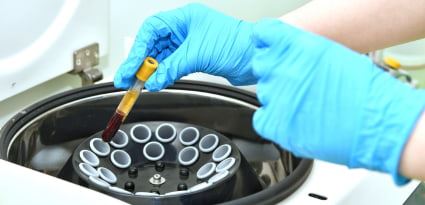 PRP Therapy for Erectile Dysfunction at JHAH: A New Long-Term Solution ...